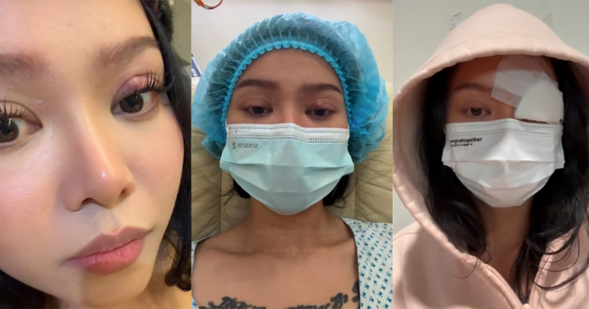 Bella Poarch returns to PH for first time in 14 years, gets eye surgery • PhilSTAR Life